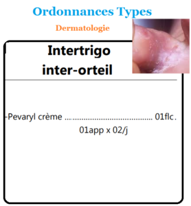 Ordonnances Types Dermatologie: Intertrigo inter-orteil – Santé Médecine