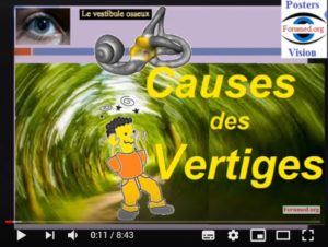 Tout savoir sur les vertiges: Mécanisme et Exploration – Santé Médecine