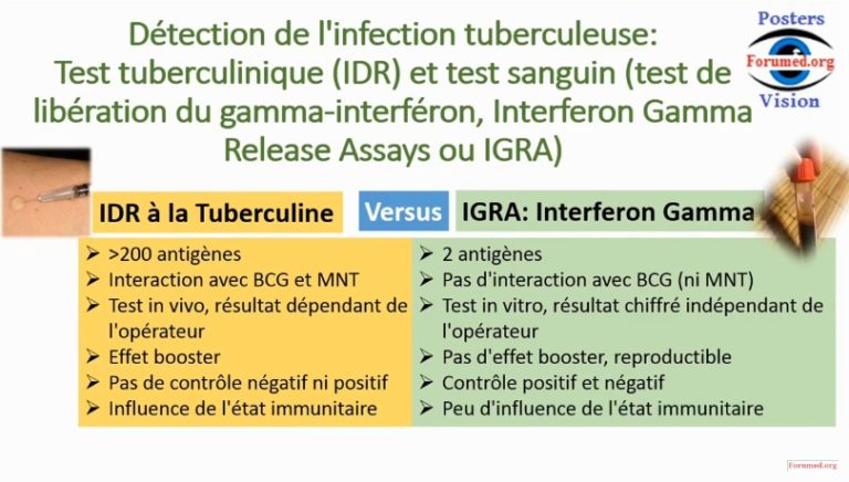 Techniques de Détection de l’infection Tuberculeuse latente IDR ou IGRA ...
